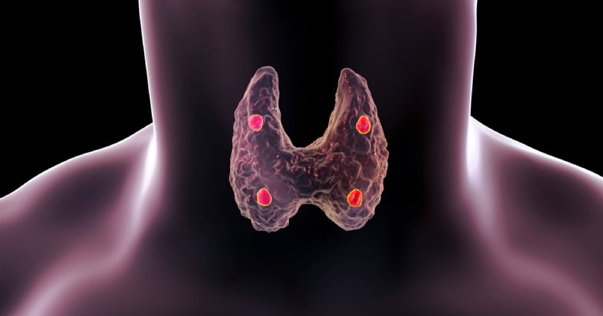 Tiroid hastalarının mutlaka bilmesi gerekenler! 12 soruda tiroid ...